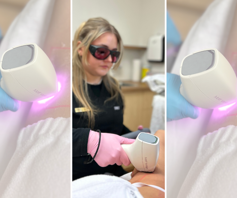 Épilation par laser, lumière pulsée, rasoir: quoi choisir? | Epiderma