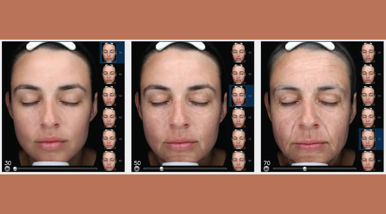 Visia Technology | Epiderma