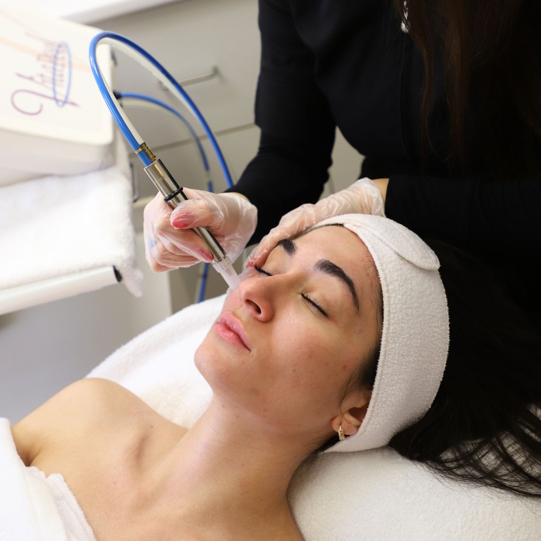 Discover the 4 essential treatments offered at Epiderma for radiant ...